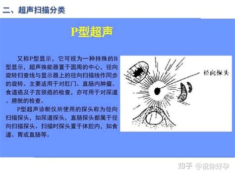超声成像的基本原理 知乎