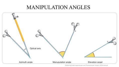 Ergonomics Of Laparoscopic Surgery Surgery Pptx