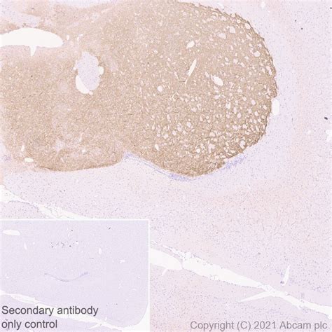 Antigen Retrieval 100x Tris Edta Buffer Ph 90 125 250 Ml Ab93684
