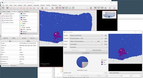 using qupath to quantify pas stains in a lung tissue image analysis