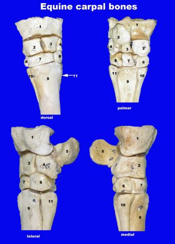 Osteology Meta Carpal Bones Flashcards Quizlet