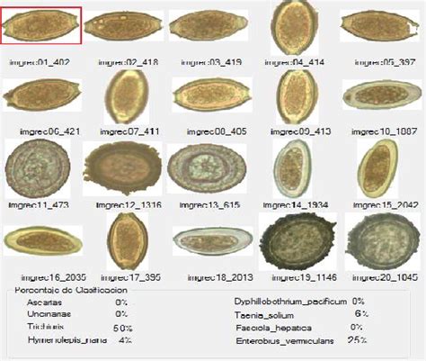 Figure 6 From Classification Of Human Parasite Eggs Based On Enhanced