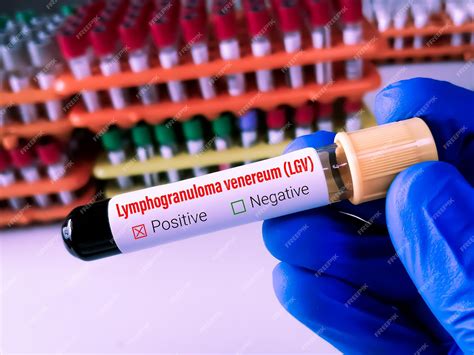 Premium Photo Blood Sample For Igra Interferon Gamma Release Assay Test