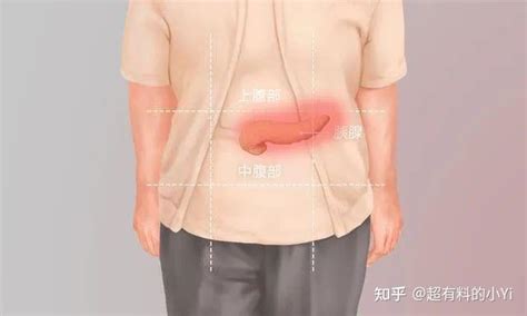 胰腺炎 一个病了会把自己 吃掉”的器官 知乎
