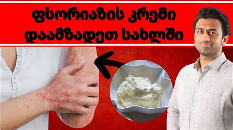 ეს კრემი სწრაფად მკურნალობს ფსორიაზს Youtube