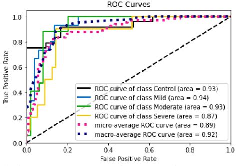 Figure 6 From Mobilenetv2 Based Diagnosis And Grading Of Limbal Stem Cell Deficiency Semantic