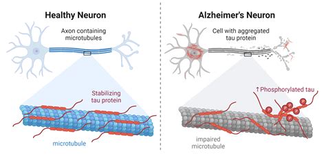Bennett Alzheimers Lab