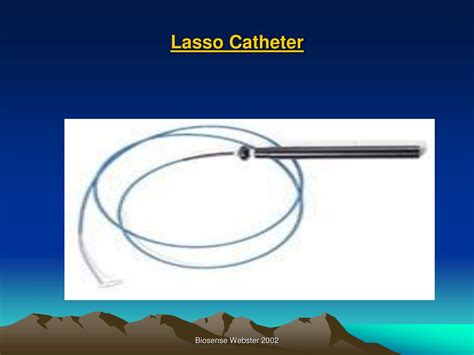 Ppt Catheter Ablation General Consideration Powerpoint Presentation