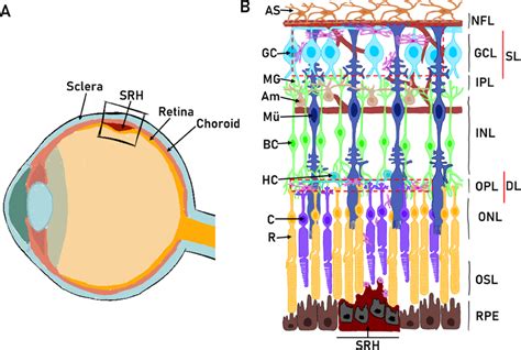 Retinal Hemorrhage Diagram Posterior Segment Photograph Right Eye