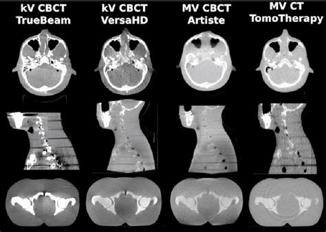 CT Images Of The Phantom Used In Setup And Download Scientific Diagram