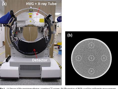 Figure 1 From Metal Artifact Reduction And Tumor Detection Using Photon Counting Multi Energy