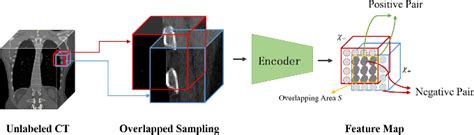 Figure 2 From A Robust Shape Aware Rib Fracture Detection And Segmentation Framework With