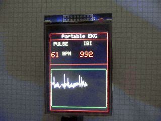 Arduino Portable EKG Monitor Arduino Ekg Arduino Projects