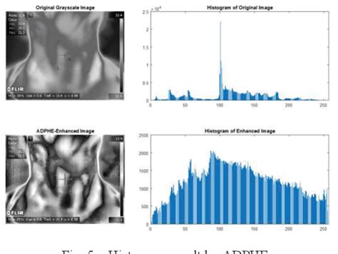 Figure 1 From An Appropriate Histogram Equalization Technique For