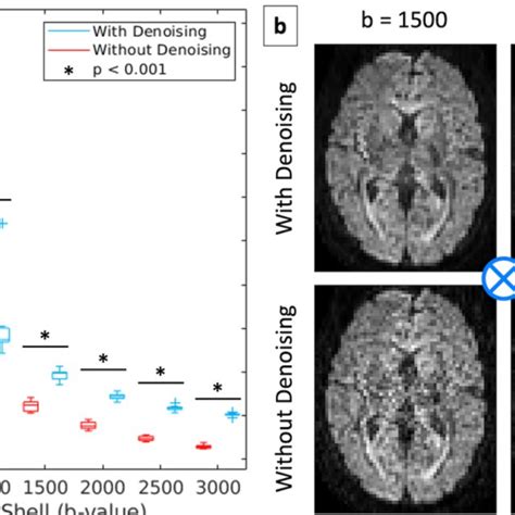 prequal improves the signal to noise ratio snr of diffusion images