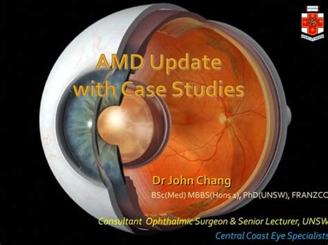 Avastin For Choroidal Neovascularization 2 2 Armd Ppt