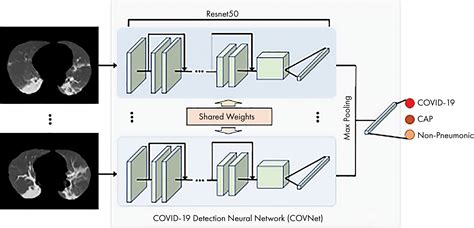Using Artificial Intelligence To Detect COVID And Community Acquired Pneumonia Based On