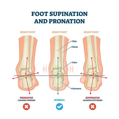 A Complete Guide Of Tibia And Fibula Stress Injuries