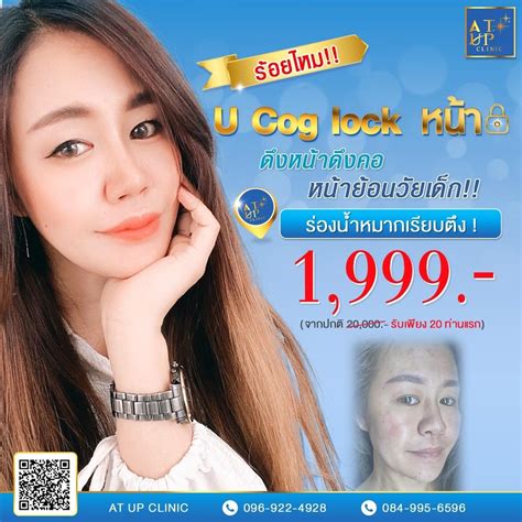 ตรงไหนหย่อน อยากยก อยากให้หน้าสมส่วน ต้องโดน ไหมตัวเด็ด U Cog Lock หน้า‼️ 🎗ดึงหน้า ดึงคอ หน้า