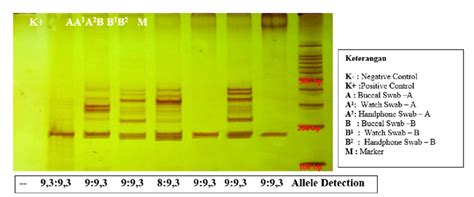 Visualization Of Str Codis Pcr Product Using At Locustho1 [156 195 Bp] Download Scientific