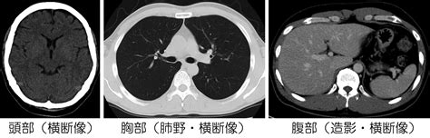 CT検査 画像部門放射線 診療科部門案内 大垣市民病院