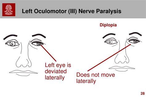 Ppt Chapter 15 Cranial Nerves Powerpoint Presentation Free Download