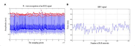 A The R Wave Recognition Eeect Diagram B The Generated Hrv Signal