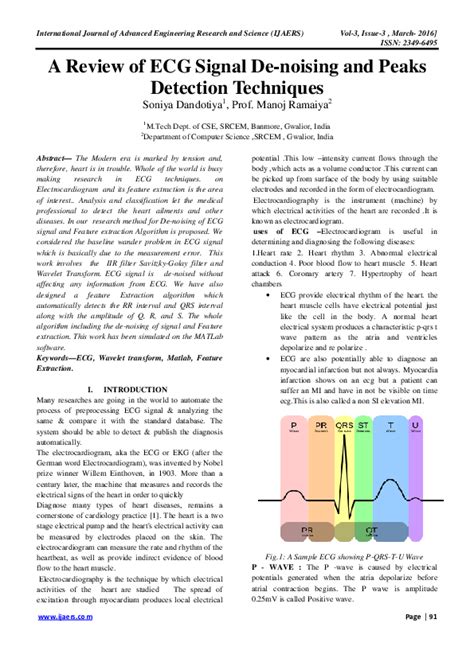 A Review Of Ecg Signal De Noising And Peaks Detection Techniques