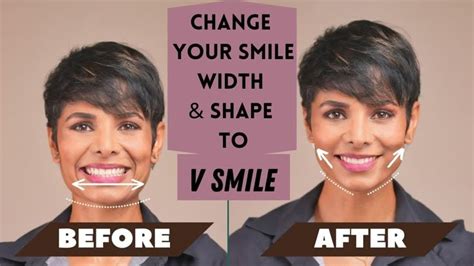 Beautiful Smile Teeth V Smile Pretty Smile Perfect Smile Teeth How