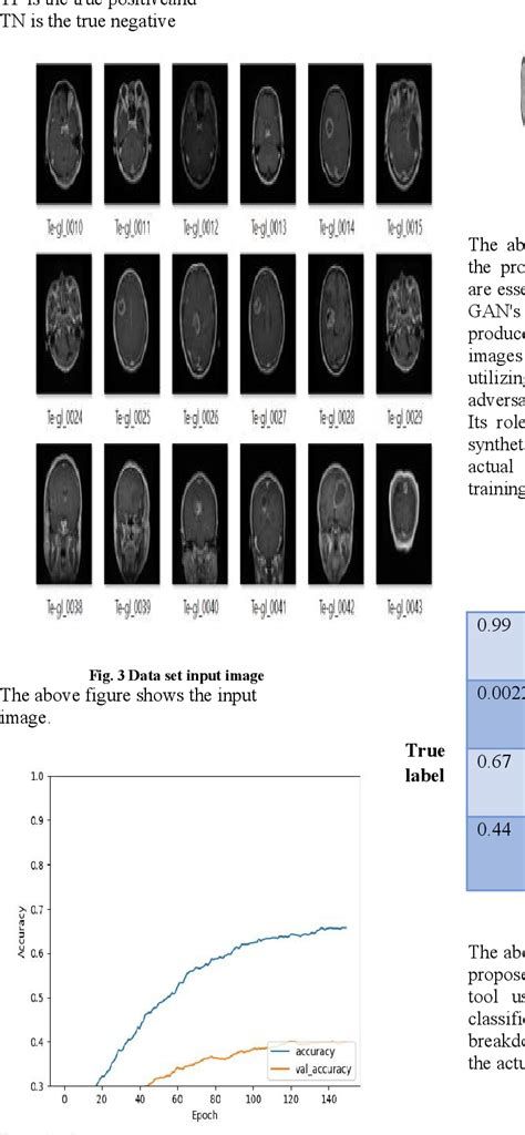 Figure 3 From Classification Of Brain Tumor Using Generative
