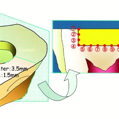 Pdf Performance Of Class I Composite Restorations When Polished