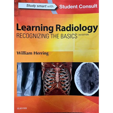 Learning Radiology Recognizing The Basics Shopee Malaysia