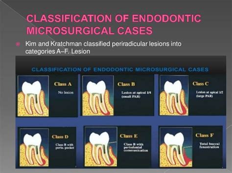 Endodontic Surgery And Its Current Concepts