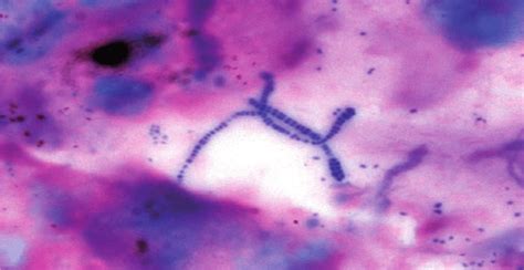 Gram Stain With Characteristic Branching Filaments With Train Track Download Scientific