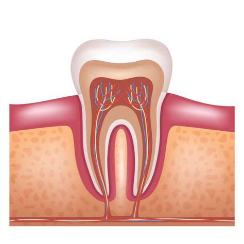 Exposed Tooth Nerve Tabor Dental Associates