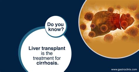 Liver Transplant Dr Harsh J Shah