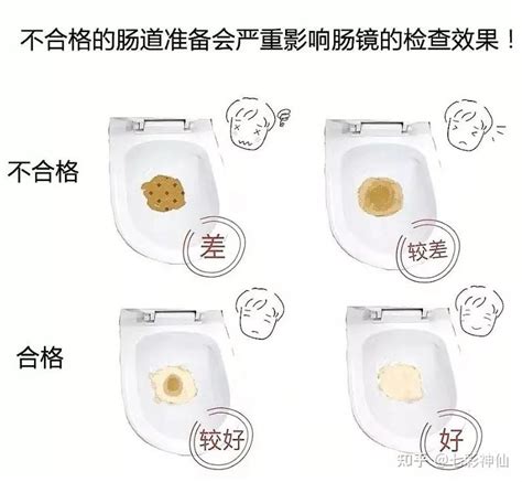 肠镜前的肠道准备可不只是喝泻药关键这步很多人都不知道 知乎