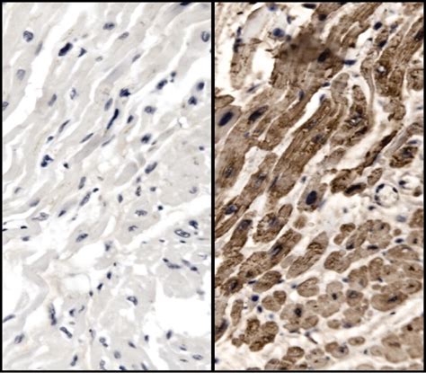 Purified Mouse Anti Cardiac Troponin T