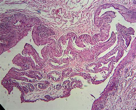 Into The Roots Squamo Columnar Junctions