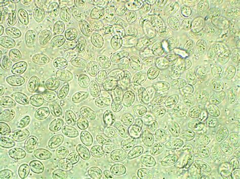 Giardia Duodenalis Cyst