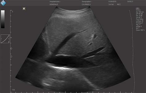 Telemed Ultrasound Home Telemed Ultrasound Home