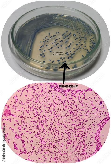 Growing Enterobacter Spp Bacteria In Chromogenic Agar Medium With Microscopic Image In