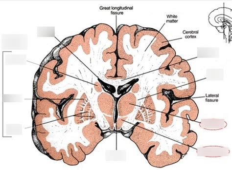 Neuro I Final Lab Exam Coronal Section Diagram Quizlet
