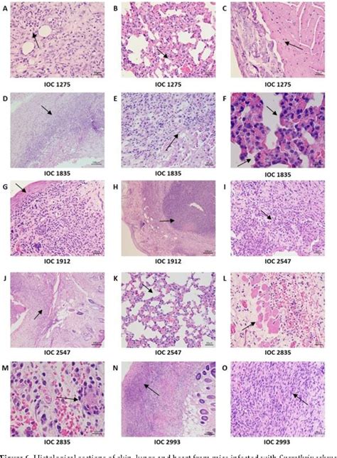Figure 2 From The Mating Type Mat And Virulence Of Sporothrix Schenckii Sensu Stricto Isolates