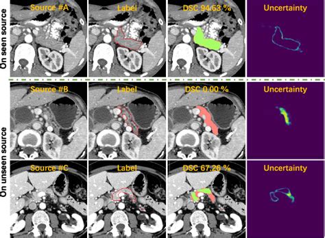figure 1 from generalizable pancreas segmentation via a dual self supervised learning framework