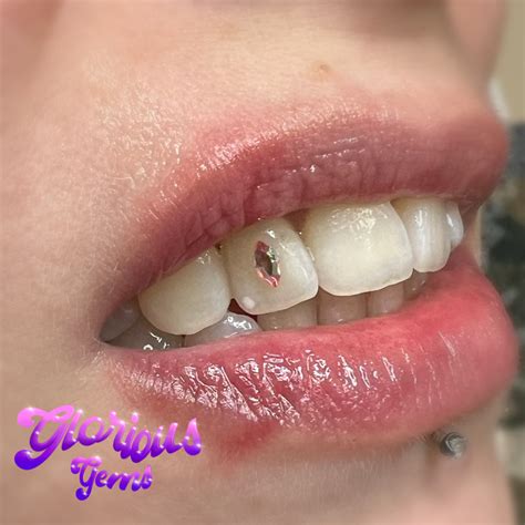 Confiez Moi La Pose De Strass Dentaires à Montluçon