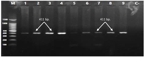 Figure 1 From Molecular Detection Of Helicobacter Pylori Infection In Gastric Biopsy Specimens
