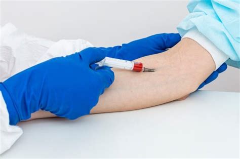 Anticoagulation Management During Invasive Procedures Hospital Procedures Consultants