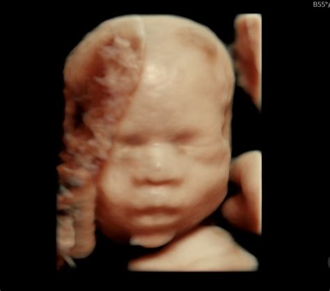 Medicina Materno Fetal Fetal Plus Sde