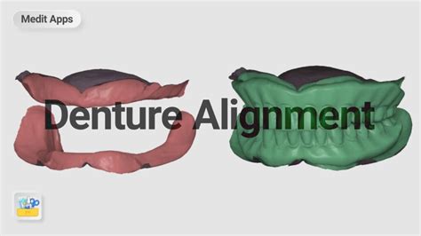 How To Align Edentulous And Denture Scan Data With The Medit Design App Medit Intraoral